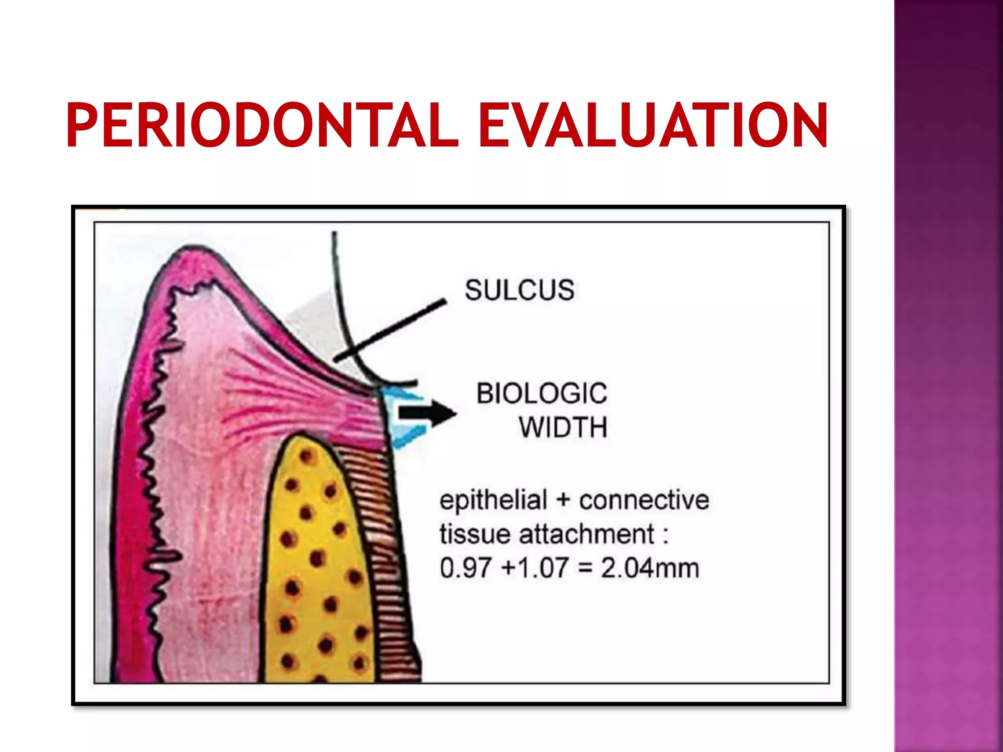 Cast post - Restoration of endodontically treated teeth | PPTX