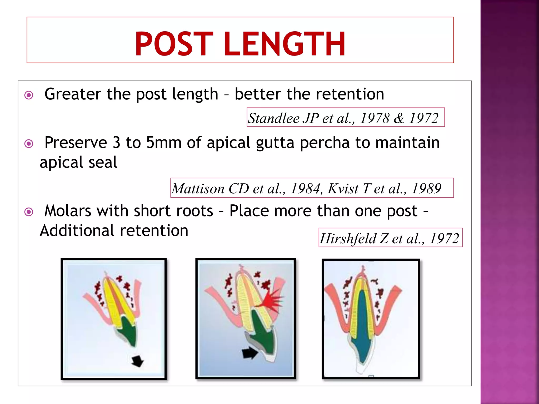 Cast post - Restoration of endodontically treated teeth | PPTX | Dental ...