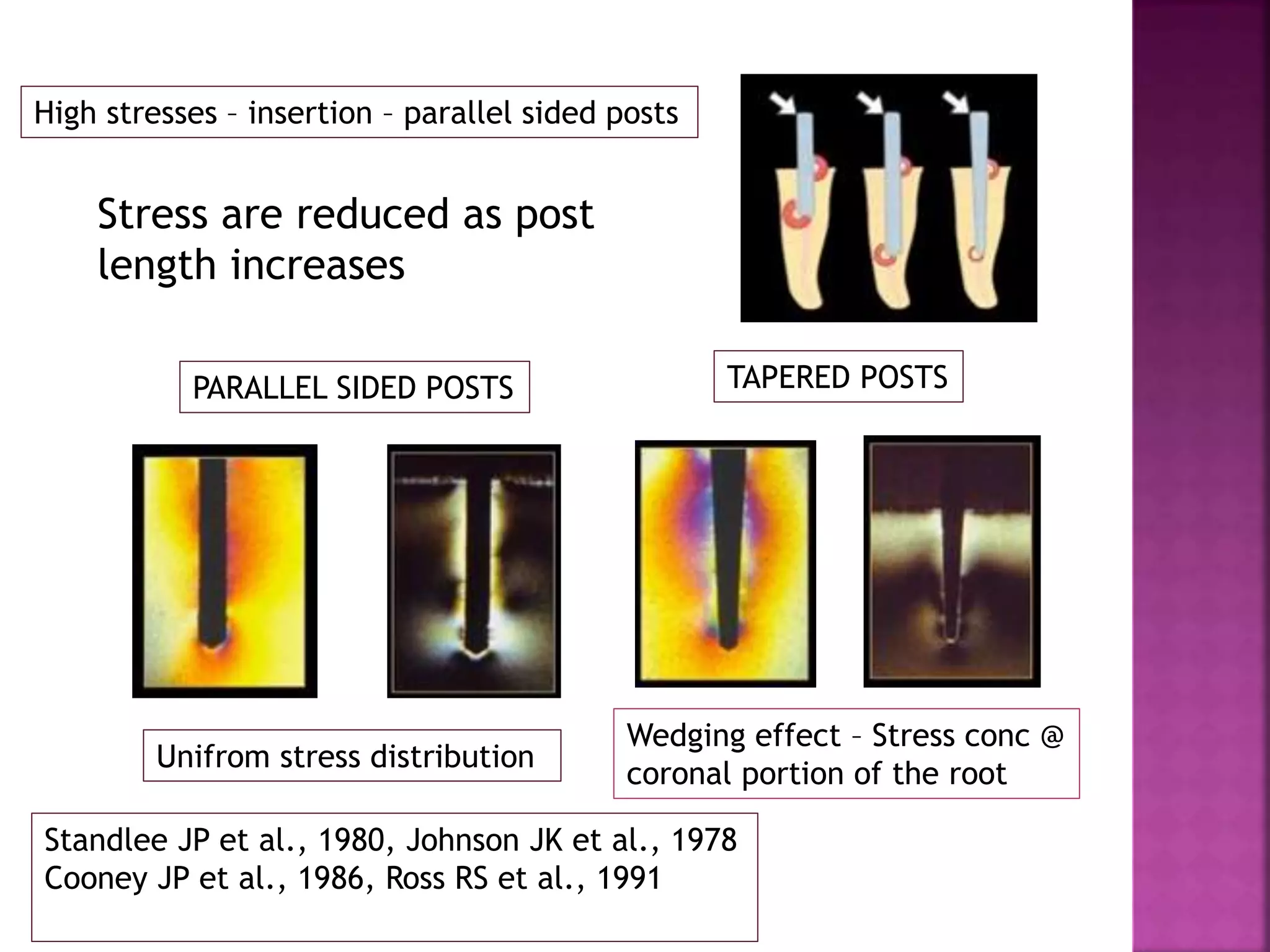 Cast post - Restoration of endodontically treated teeth | PPTX