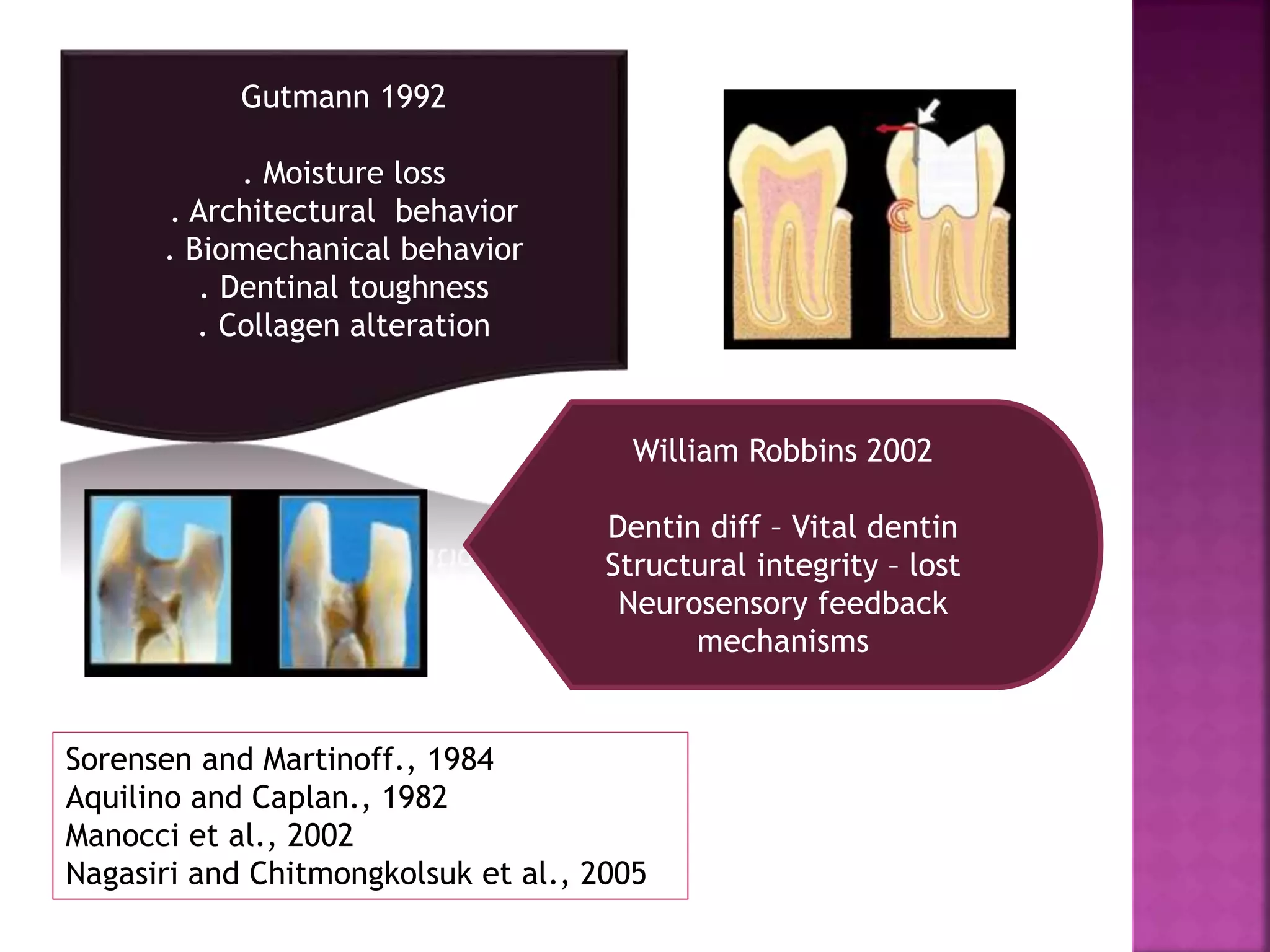 Cast post - Restoration of endodontically treated teeth | PPTX | Dental ...