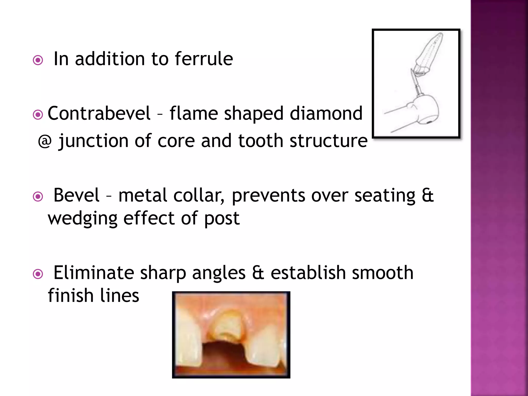 Cast post - Restoration of endodontically treated teeth | PPTX
