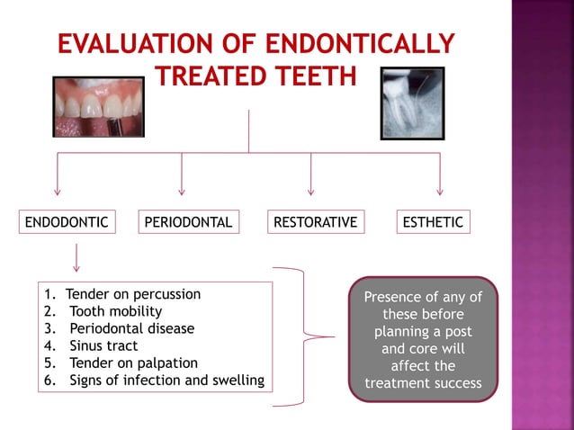 Cast post - Restoration of endodontically treated teeth | PPTX | Dental ...