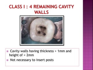 Cast post - Restoration of endodontically treated teeth | PPTX