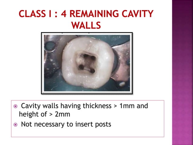Cast post - Restoration of endodontically treated teeth | PPTX | Dental ...