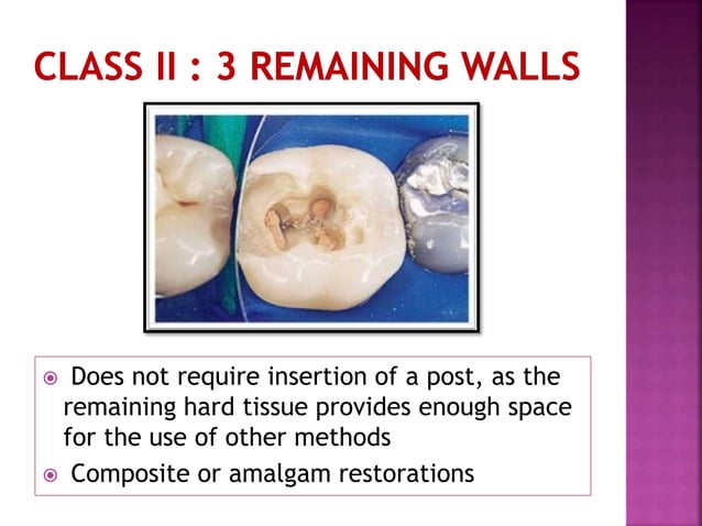 Cast post - Restoration of endodontically treated teeth | PPTX | Dental ...