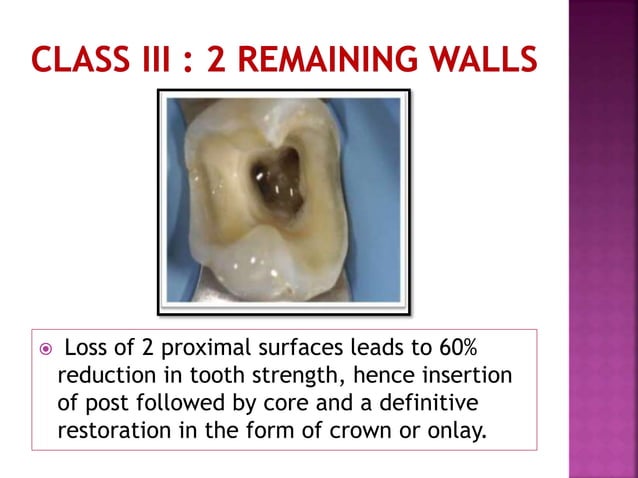 Cast post - Restoration of endodontically treated teeth | PPTX | Dental ...
