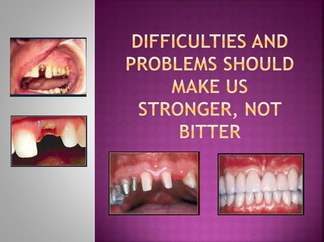 Cast post - Restoration of endodontically treated teeth | PPTX | Dental ...