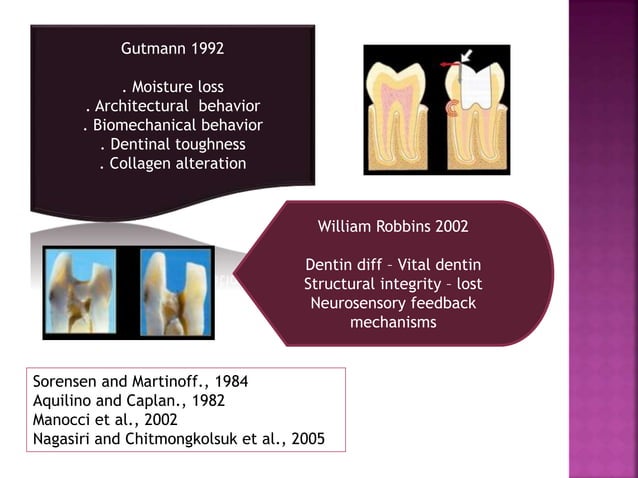 Cast post - Restoration of endodontically treated teeth | PPTX | Dental ...