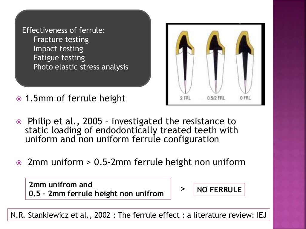 Cast post - Restoration of endodontically treated teeth