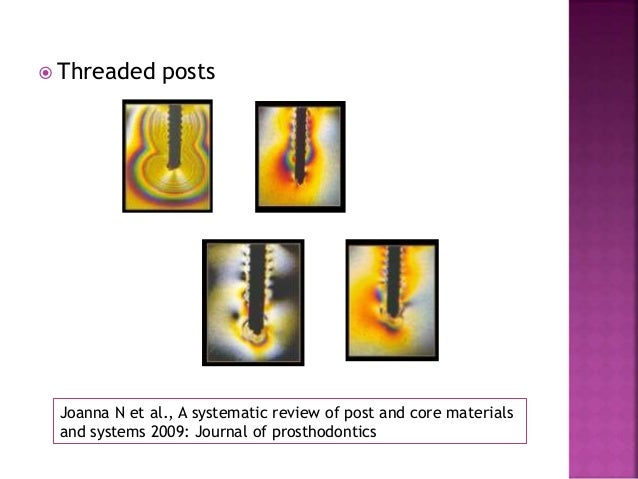Cast post - Restoration of endodontically treated teeth