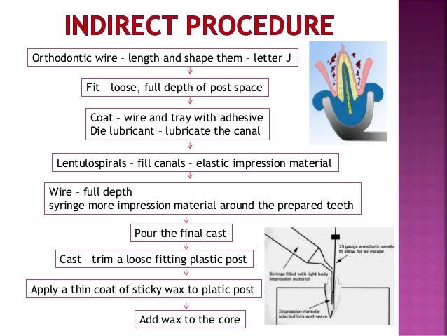 Cast post - Restoration of endodontically treated teeth