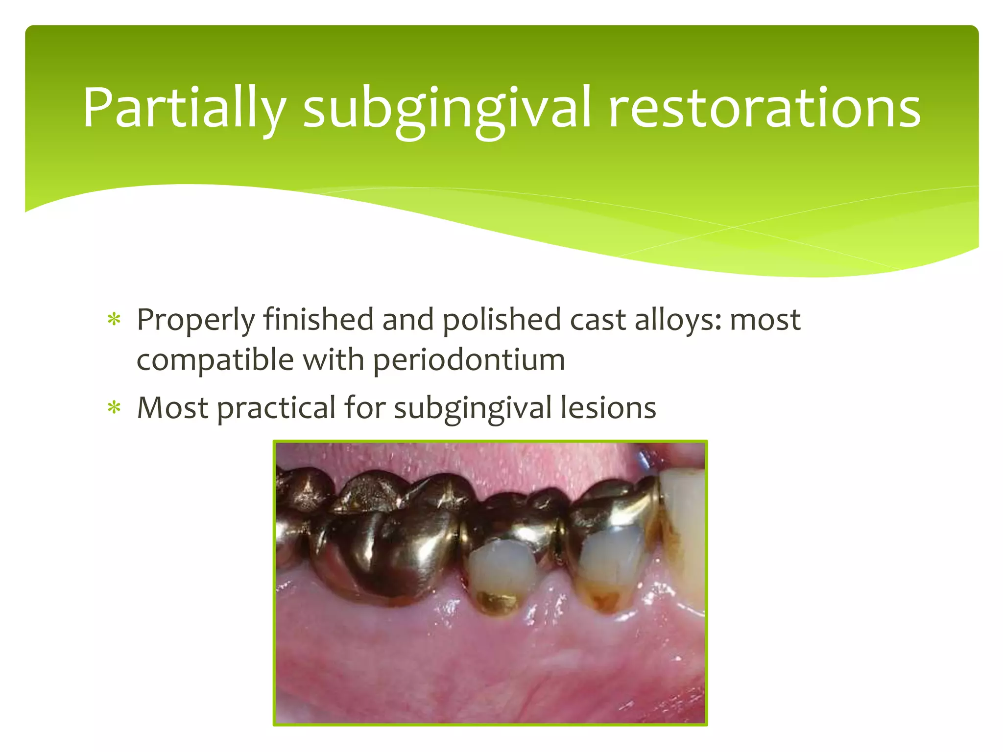 Cast restorations | PPTX