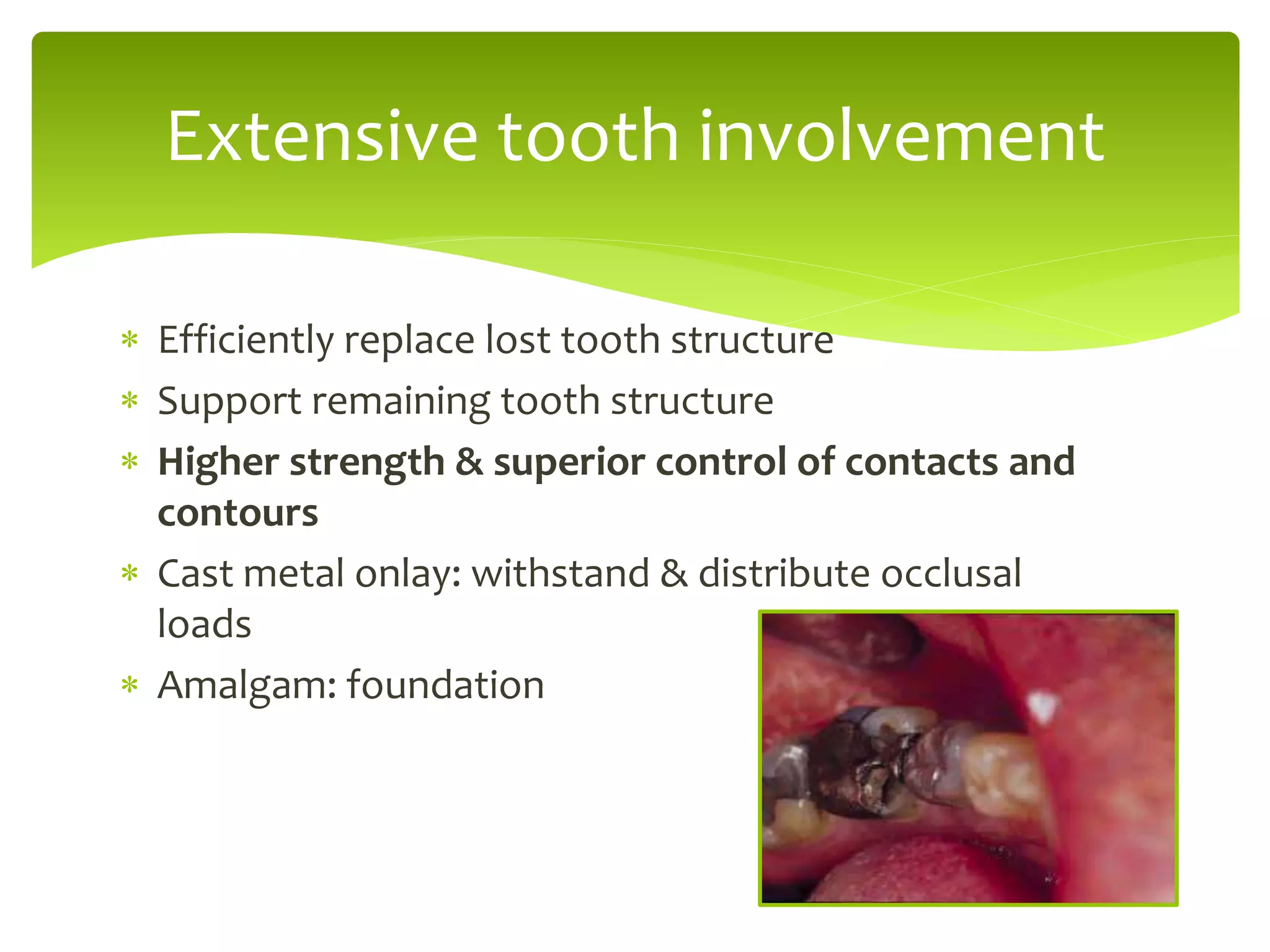Cast restorations | PPTX