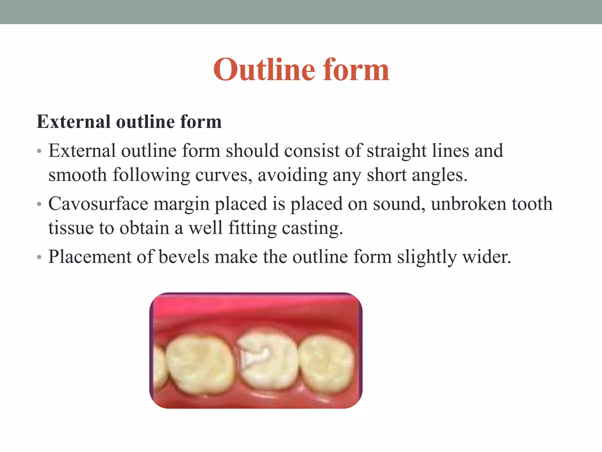 Cavity preparation for cast metal restorations | PPTX