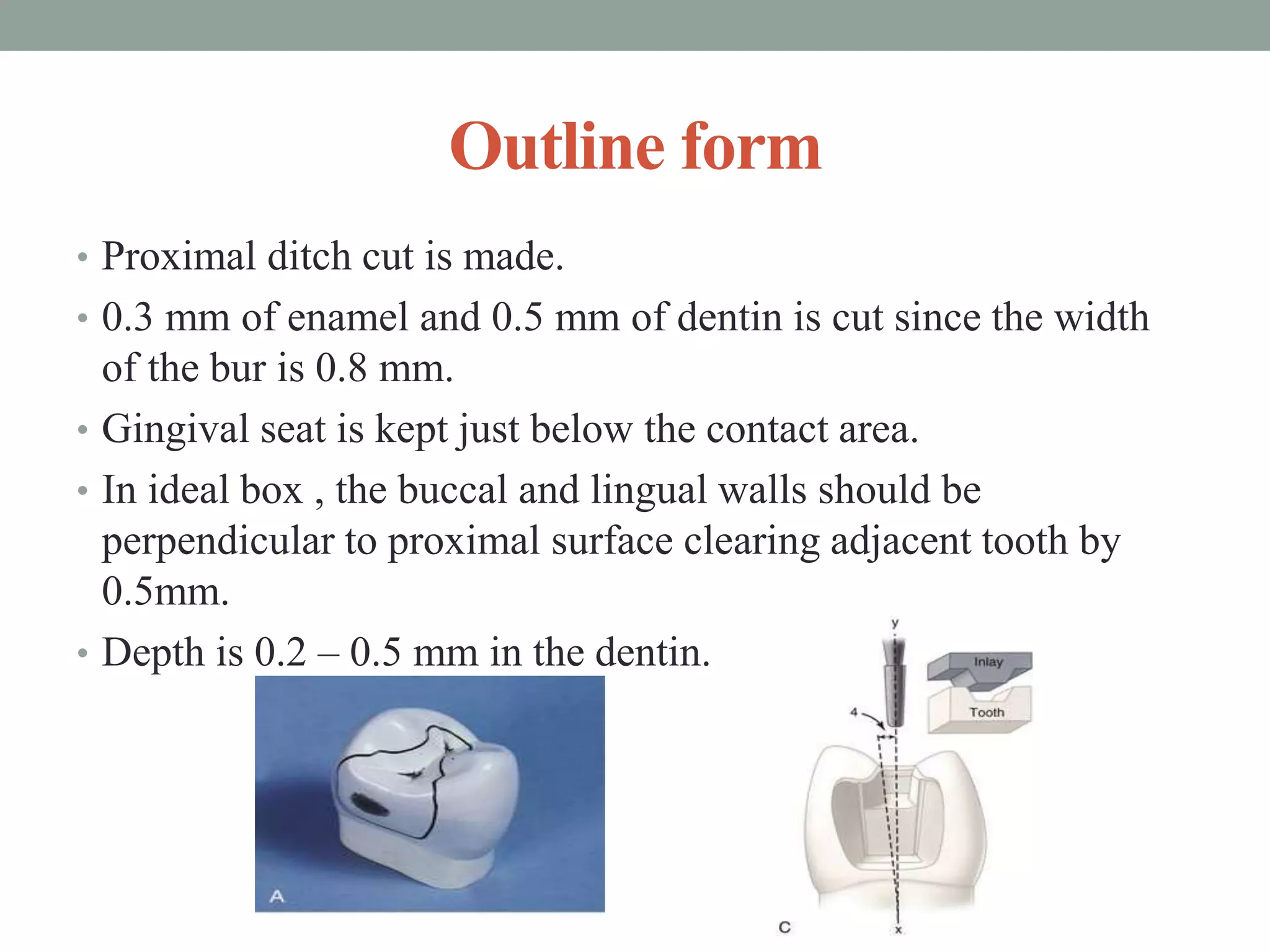 Cavity preparation for cast metal restorations | PPTX