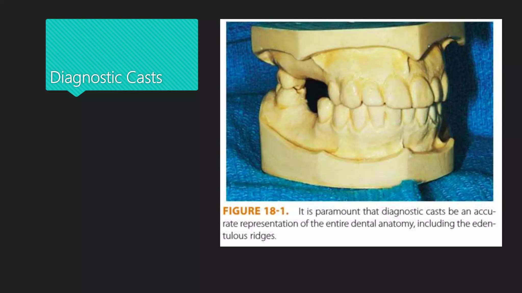 Diagnostic Casts,surgical templates and provisionalization | PPTX