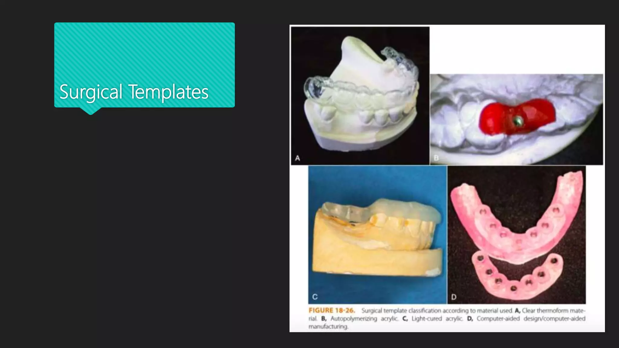 Diagnostic Casts,surgical templates and provisionalization | PPTX