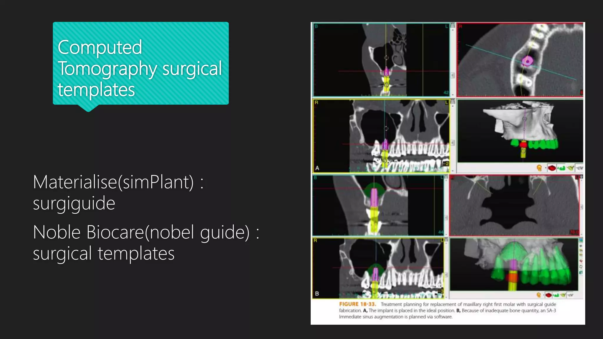 Diagnostic Casts,surgical templates and provisionalization | PPTX
