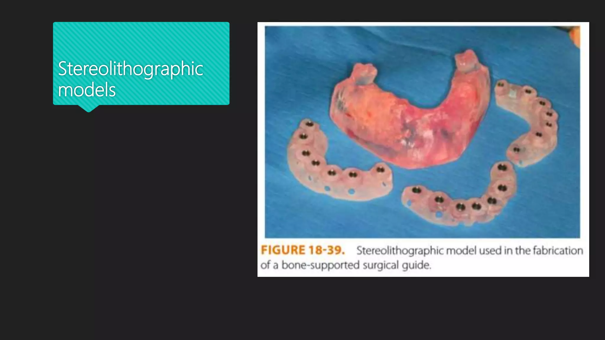 Diagnostic Casts,surgical templates and provisionalization | PPTX