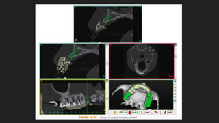 Diagnostic Casts,surgical templates and provisionalization | PPTX