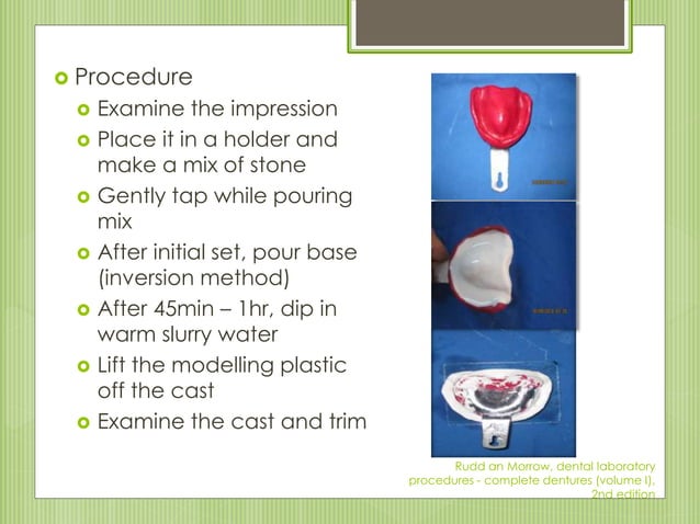 Casts, dies and cast forming | PPTX | Oral care | Personal Care