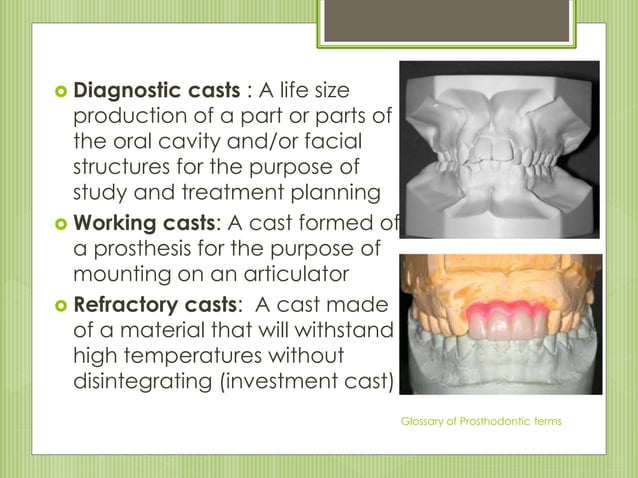 Casts, dies and cast forming | PPTX | Oral care | Personal Care