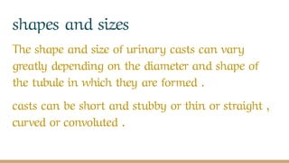 Casts in urine - Routine | PDF