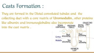 Casts in urine - Routine | PDF