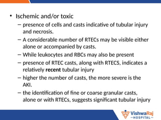 Casts in Urine Analysis nephrology .pptx | Medical Tests | Medical Health