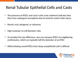 Casts in Urine Analysis nephrology .pptx | Medical Tests | Medical Health