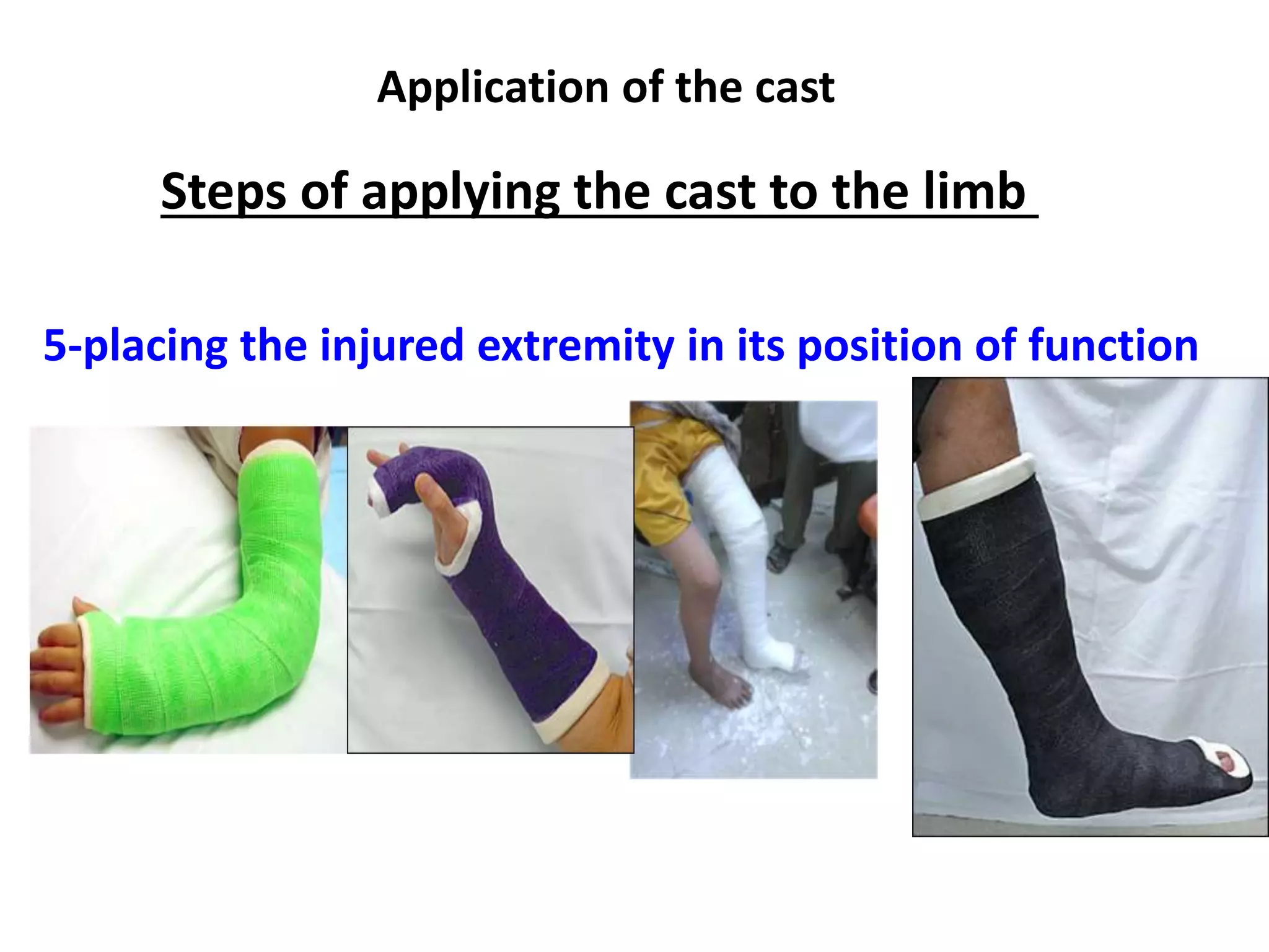 Cast & slab by dr. ahmed shedeed | PPTX