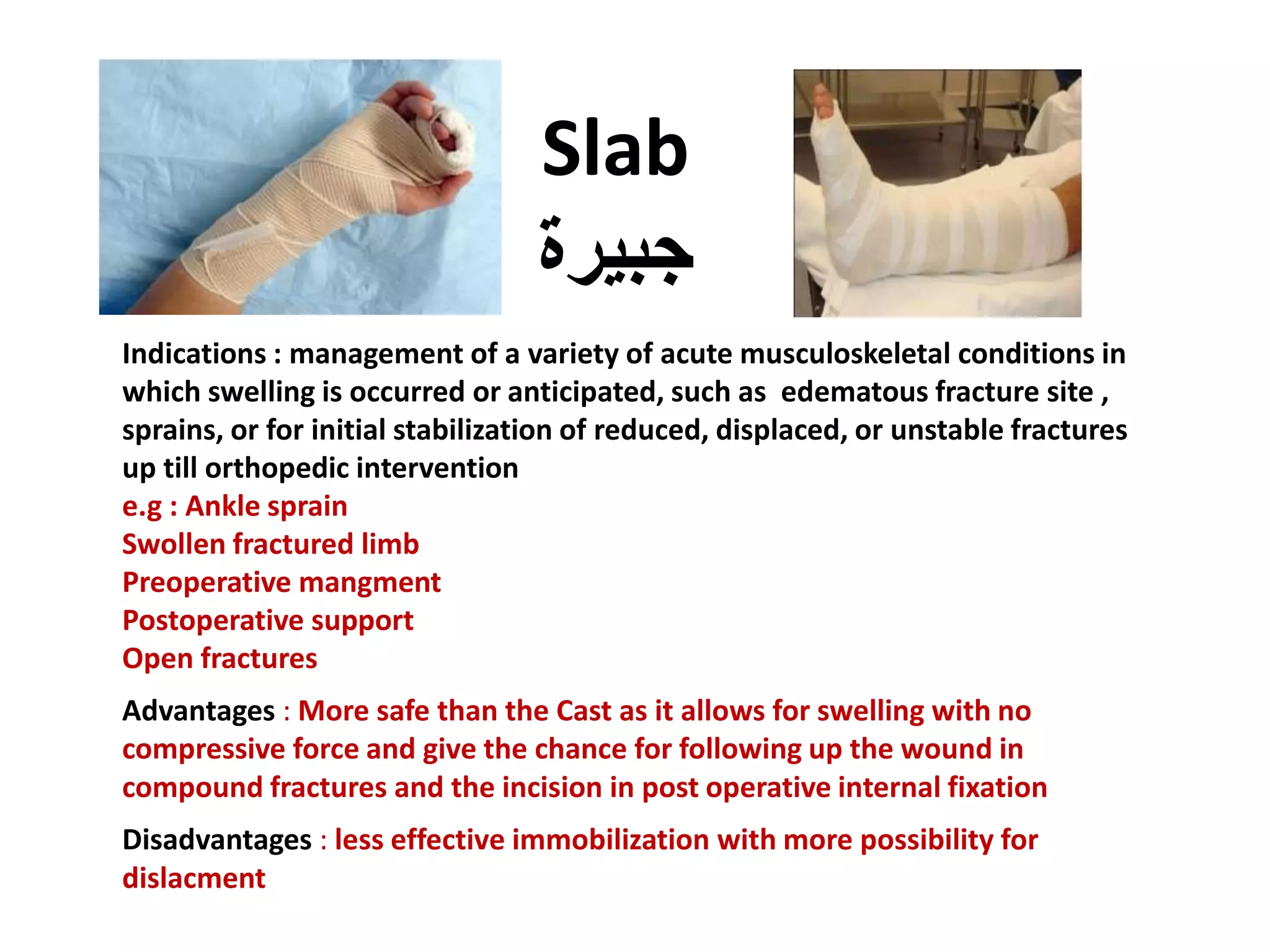 Cast & slab by dr. ahmed shedeed | PPTX