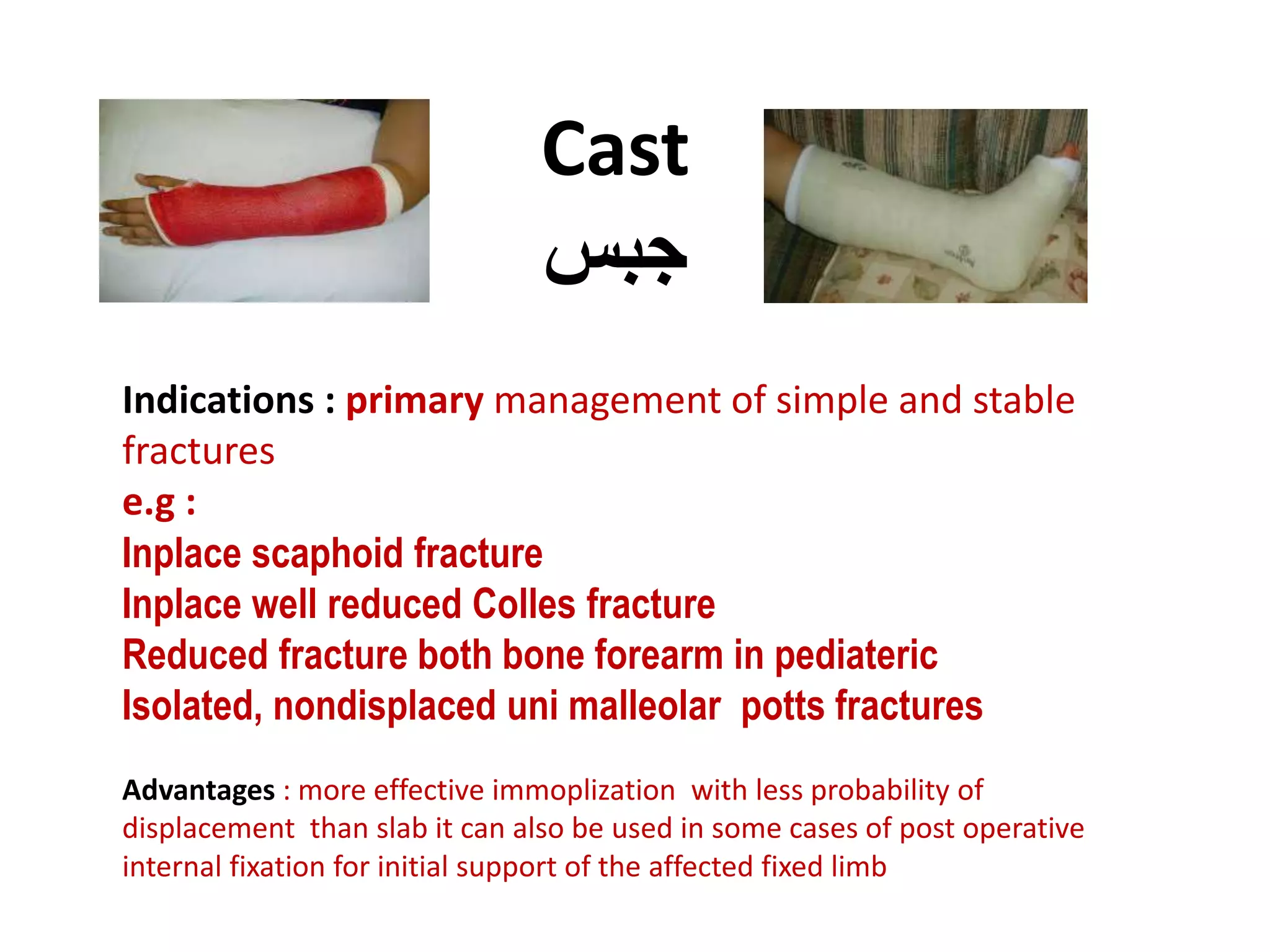 Cast & slab by dr. ahmed shedeed | PPTX