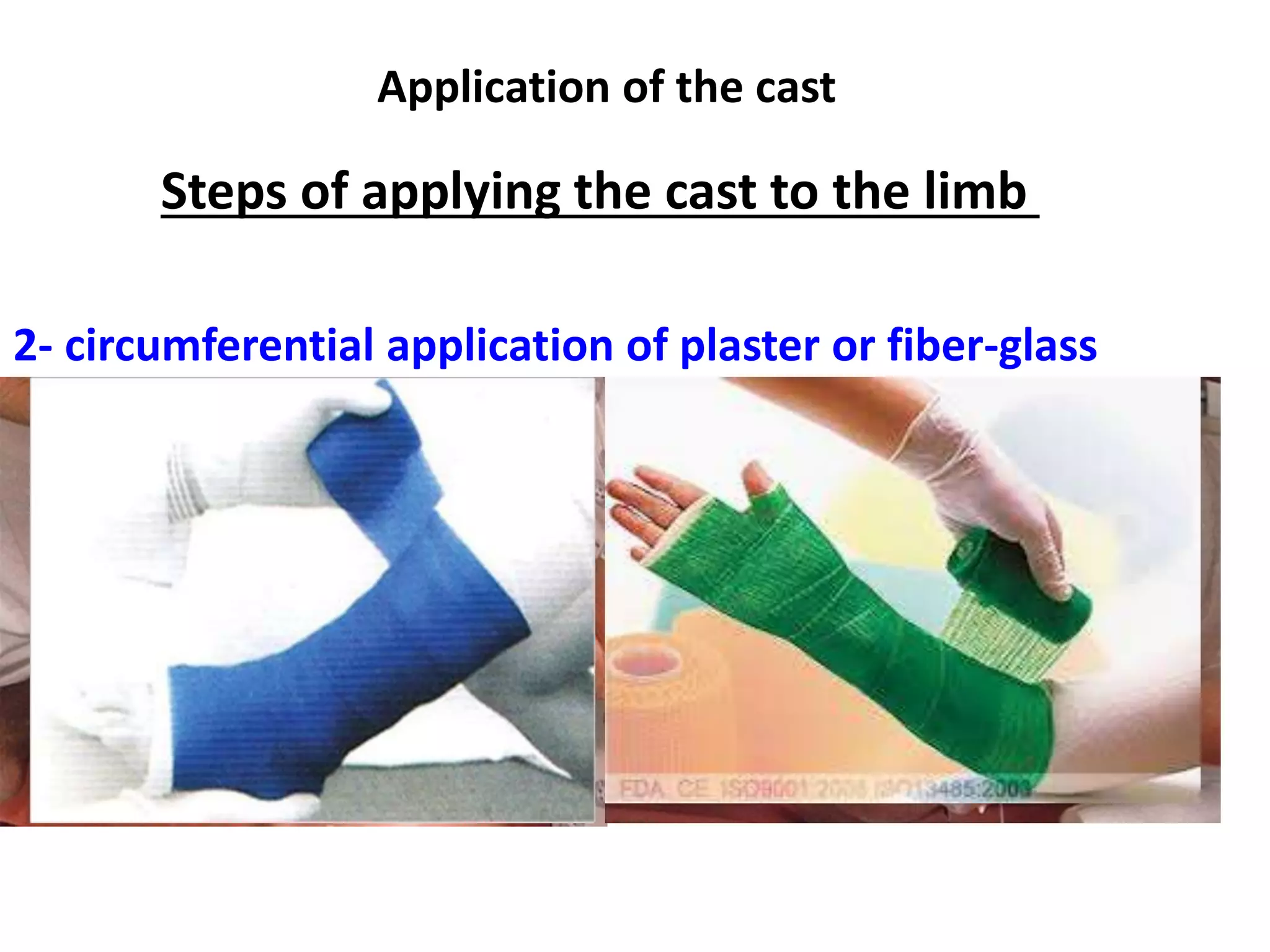 Cast & slab by dr. ahmed shedeed | PPTX