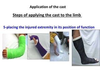 Cast & slab by dr. ahmed shedeed | PPTX