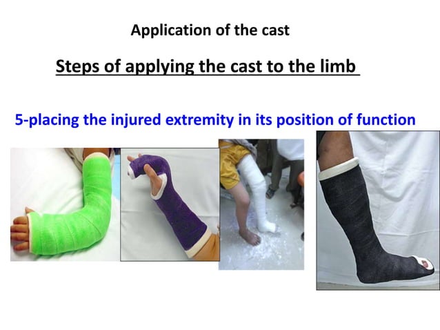 Cast & slab by dr. ahmed shedeed | PPTX