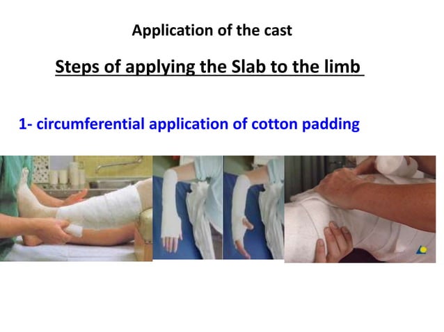 Cast & slab by dr. ahmed shedeed | PPTX