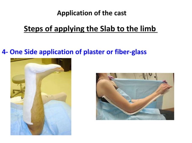 Cast & slab by dr. ahmed shedeed | PPTX