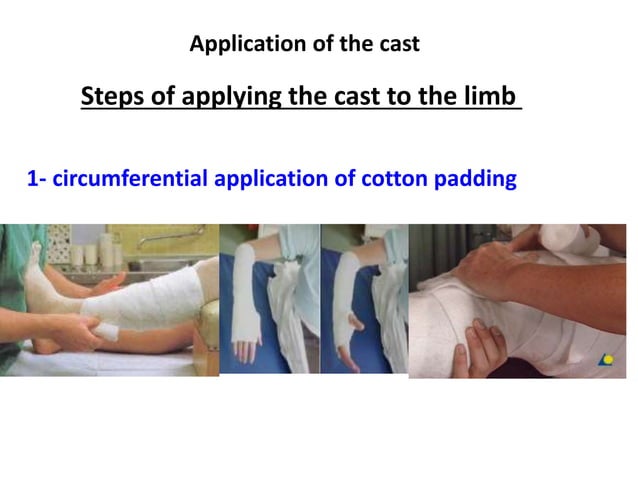 Cast & slab by dr. ahmed shedeed | PPTX