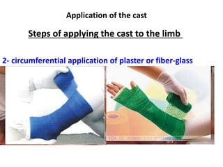 Cast & slab by dr. ahmed shedeed | PPTX