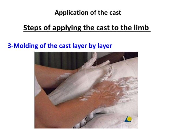 Cast & slab by dr. ahmed shedeed