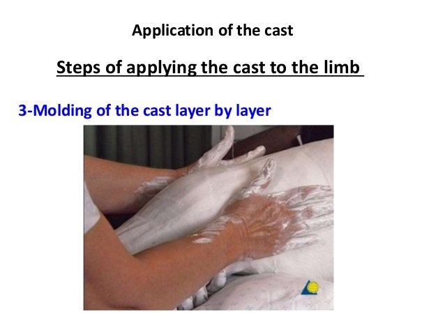 Cast & slab by dr. ahmed shedeed