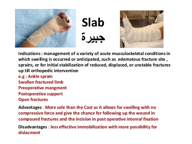 Cast & slab by dr. ahmed shedeed