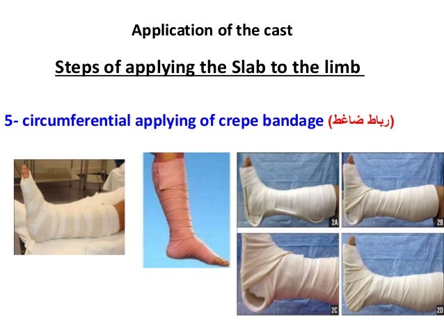 Cast & slab by dr. ahmed shedeed