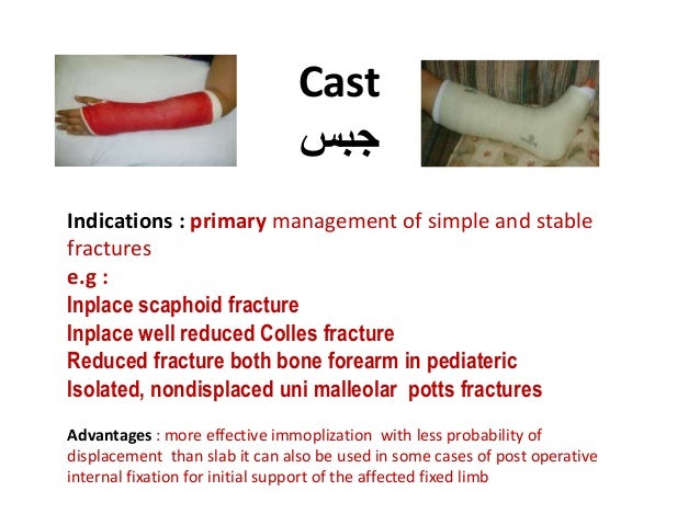 Cast & slab by dr. ahmed shedeed