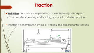 CAST,SPLINTS,TRACTION.pptx By Sanjay Acharya | PPTX