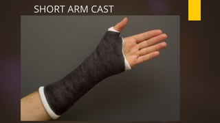 CASTS & SPLINTS types and picture (nursing).pptx