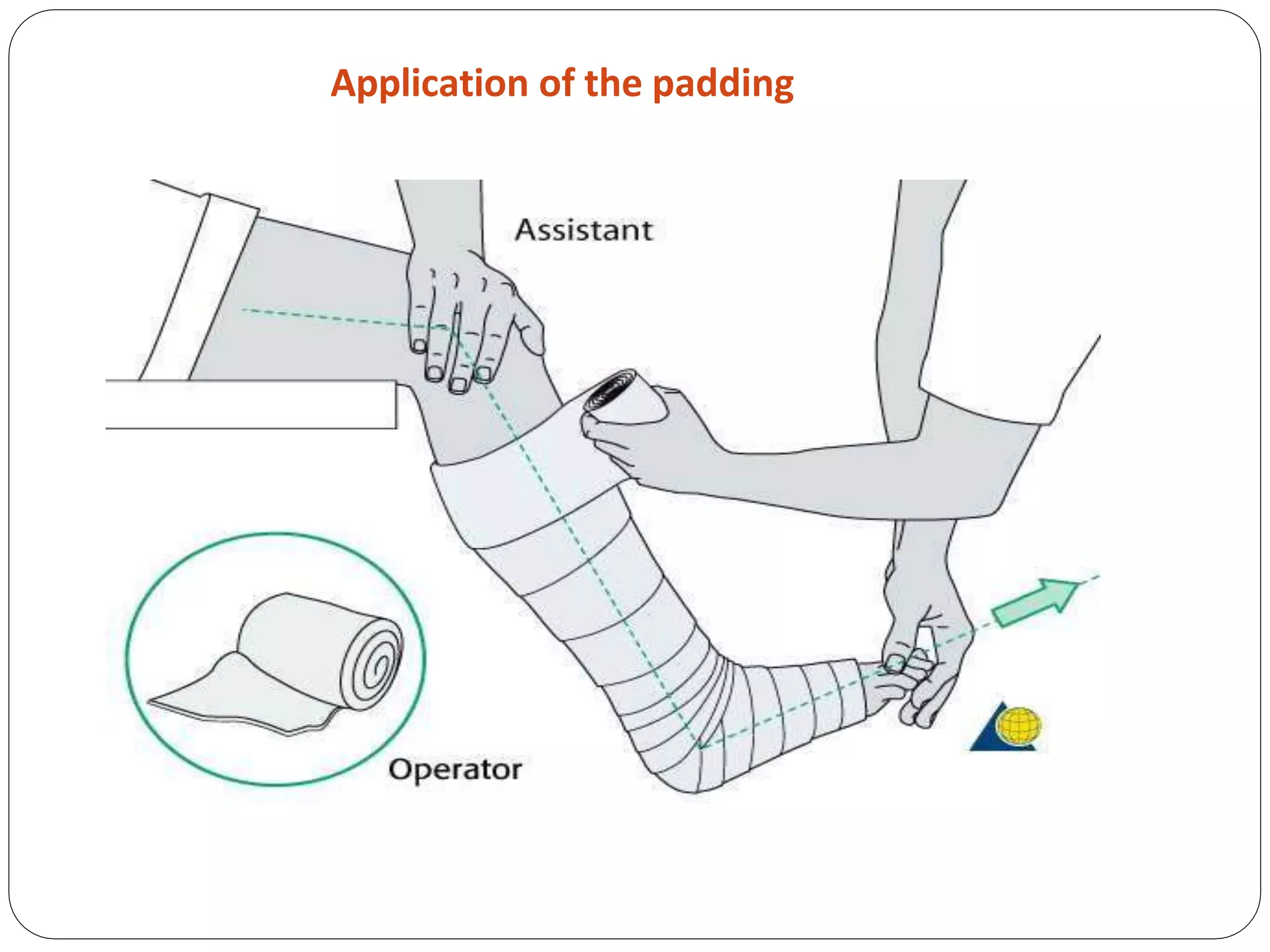 POP PLASTER AND CAST TECHNIQUES | PPTX