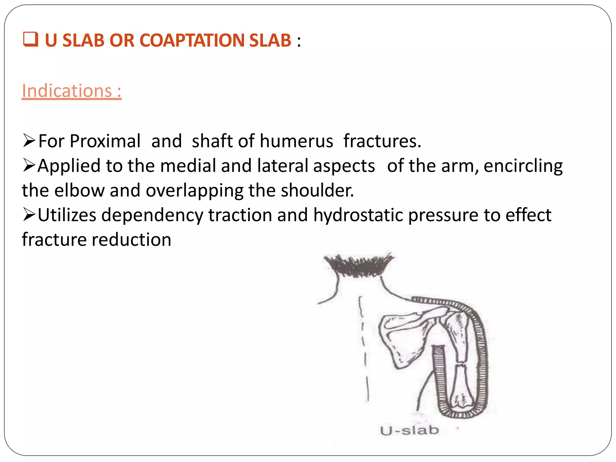 POP PLASTER AND CAST TECHNIQUES | PPTX