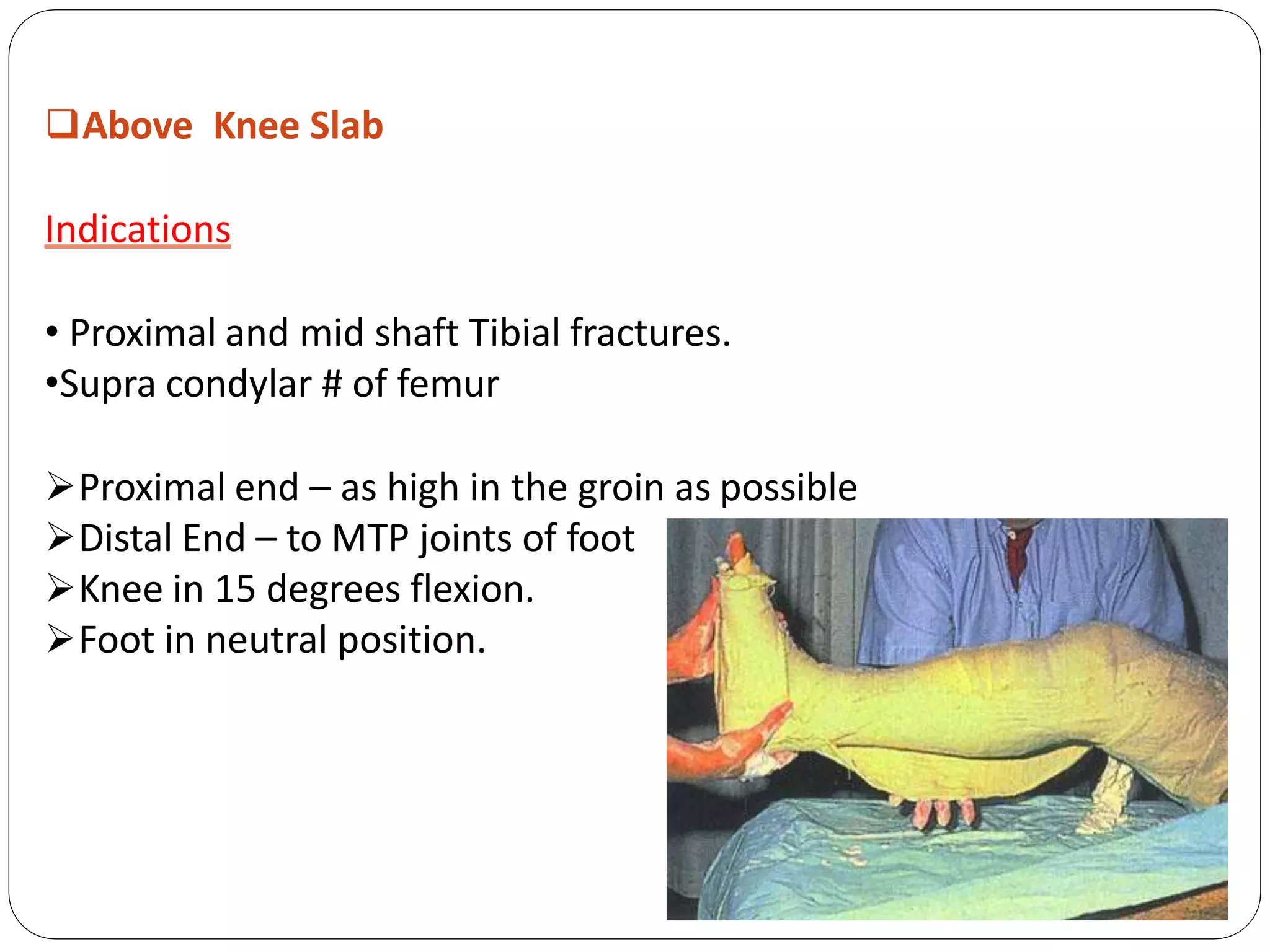 POP PLASTER AND CAST TECHNIQUES | PPTX